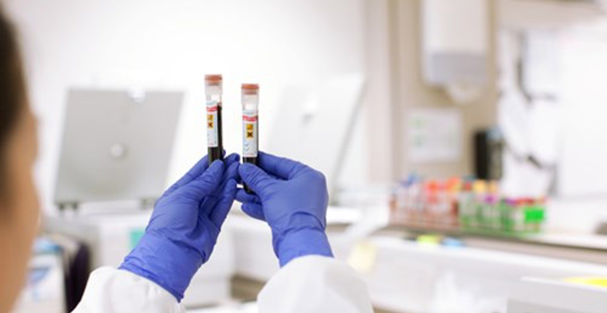 Blood test to detect cancer returning reaches final trial stage